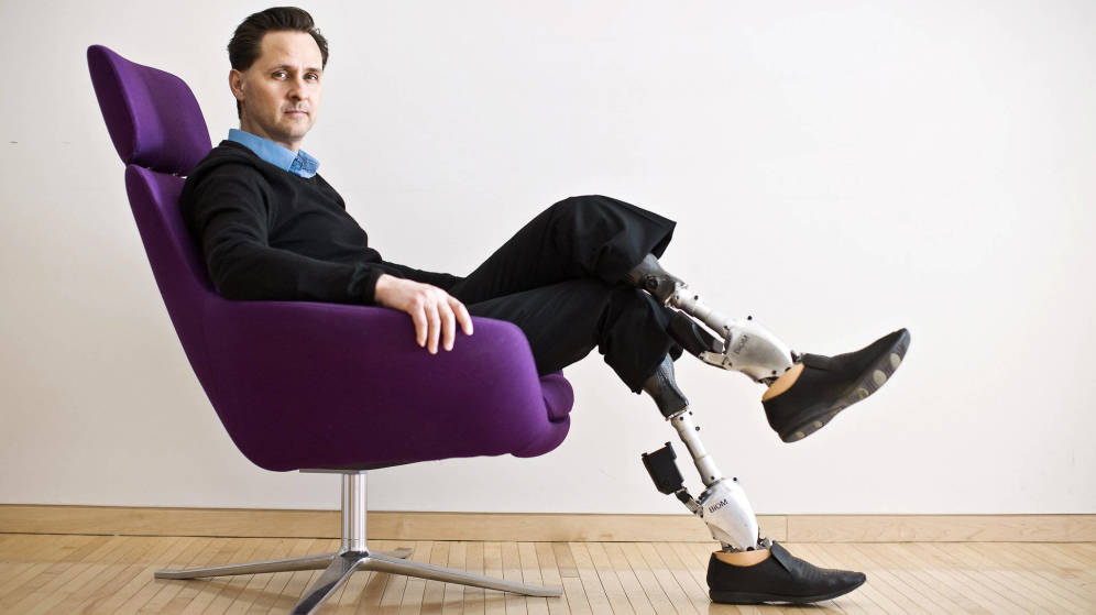 Avances en prótesis humanas - Magazine Z